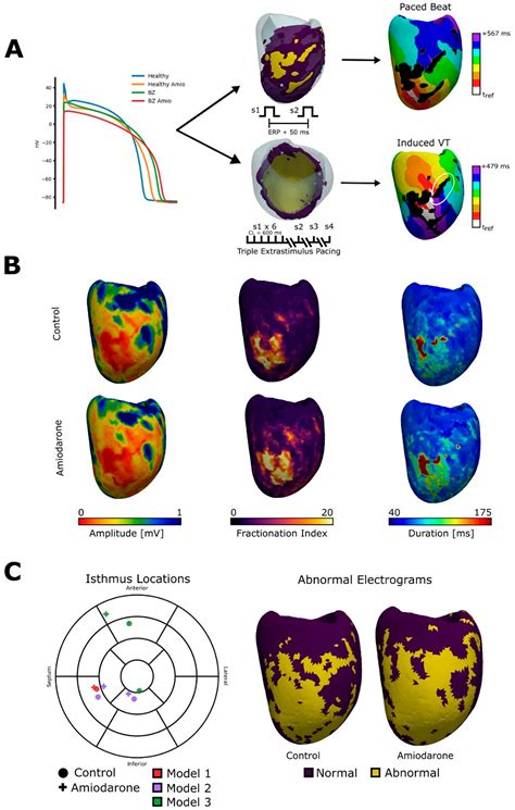 Po 06 122 Exploring The Effect Of Amiodarone On Substrate Mapping For