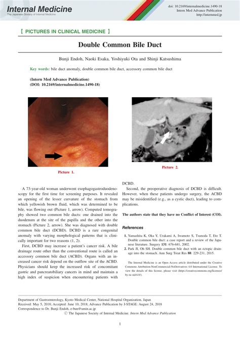 Pdf Double Common Bile Duct