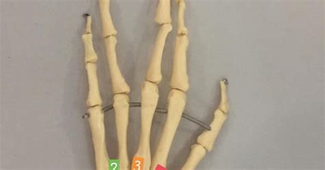 Anatomia Humana Vespertino Aula Acidentes ósseos