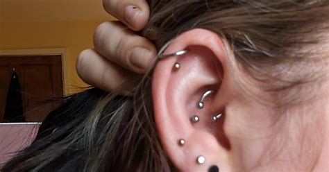 Helix Placement Album On Imgur