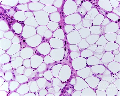 Adipose Tissue 1 Photograph By Science Photo Library Pixels Merch