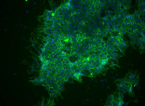 Purified Mouse Anti Human Alkaline Phosphatase Purified Mouse Anti Human Alkaline Phosphatase