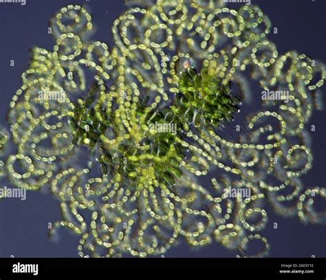 Anabaena Cyanobacteria Polarised Light Micrograph Of Filamentous Colonies Of Anabaena Sp