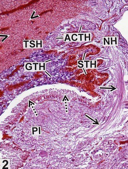 Showing Dense Population Of Prolactin Cells Prl Arrow Heads