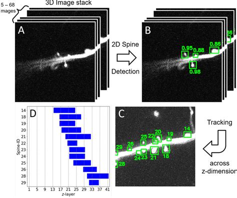 Overview Of Spine Detection Pipeline Illustrated Using One Example Download Scientific Diagram