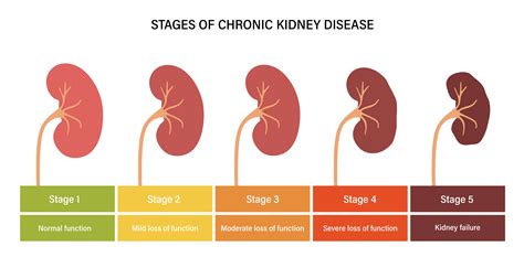 Understanding Common Lab Results Associated With Ckd