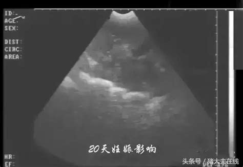 B超檢查母豬妊娠，詳細圖文教你識別 每日頭條