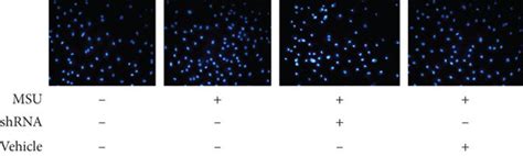A Protein Levels Of Cyr61 Il 1β Il 6 And Tnf α In The Blank Or