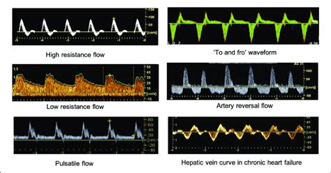 spectral inflections in v t curve diagrams illustrate how normal