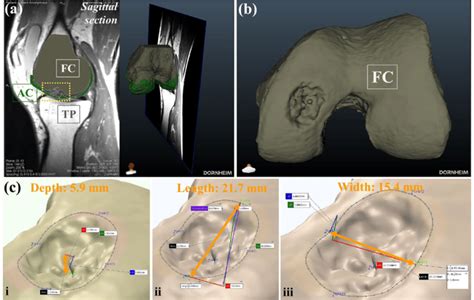Defect Site Modeling A Identification Segmentation And 3d Modeling Download Scientific