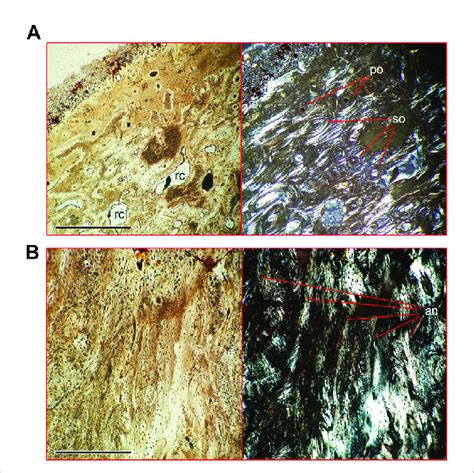 Microanatomical Structure Of The Cortex Of Pelvic Bone Nmnh P Cs 513
