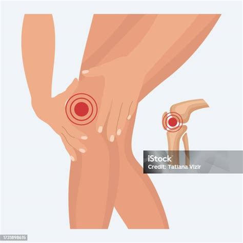 Pain In The Knee Joint Knee Arthritis Leg Pain Due To Rheumatoid