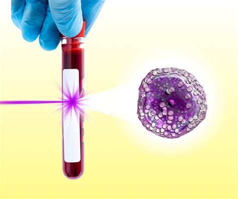 Leveraging Flow Cytometry To Drive Better Patient Outcomes In
