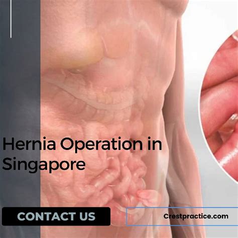 Stream Understanding Hernia Operation In Singapore Types Procedures