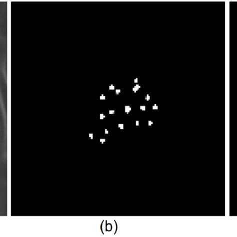 segmentation result in one test patient a ct image display window