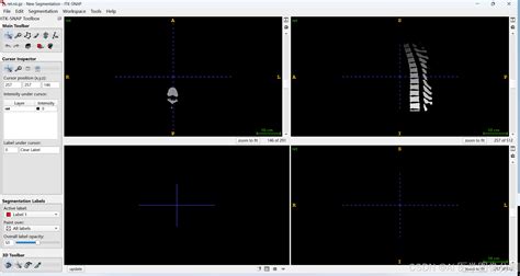 Nnunet 大模型学习笔记（续）：3dfullres 模型的推理、切片推理、计算dice系数nnunet库的单个nii文件推理 Csdn博客