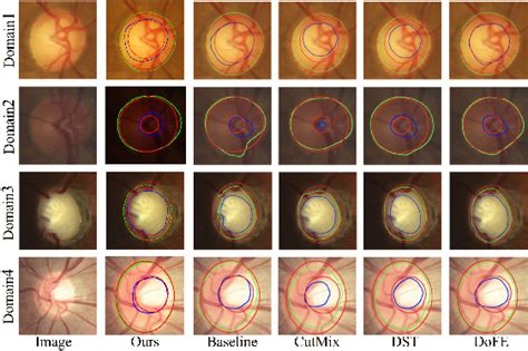 Figure 1 From A Random Feature Augmentation For Domain Generalization