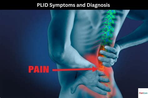 What Is Plid Disease A Complete Guideline Of Plid