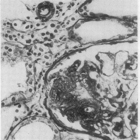 Electron Micrograph Polymorphonuclear Leukocytes Are Found In Part Of Download Scientific
