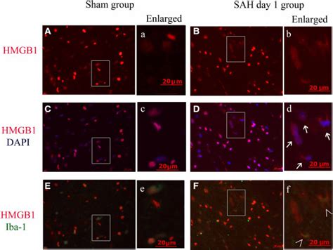 Cytosolic Expression Of High Mobility Group Box 1 Hmgb1 In Ionized Download Scientific