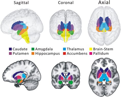 Locations Of The Subcortical Regions Each Region Is Labeled With