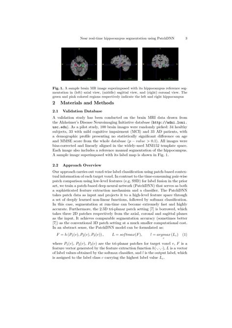 Near Real Time Hippocampus Segmentation Using Patch Based Canonical Neural Network Deepai