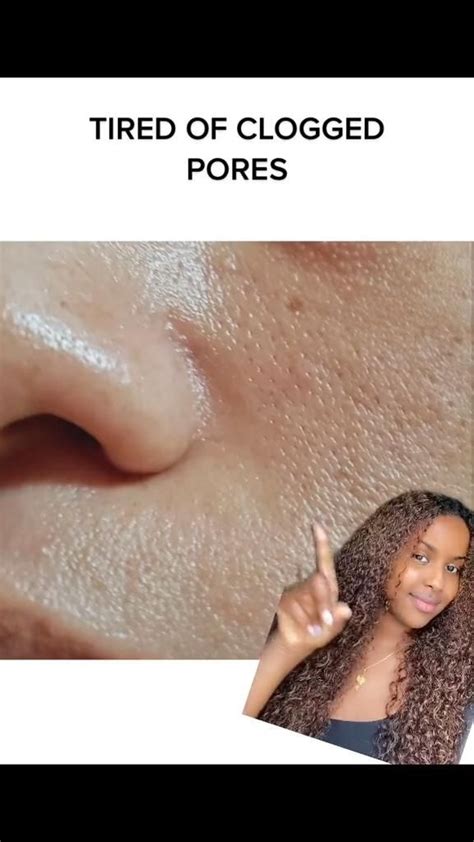 How To Get Rid Of Clogged Pores Artofit