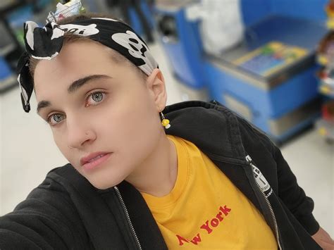 Recently Lost All My Hair To A Rare Diseasetrying My Best To Gain