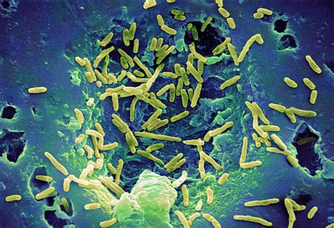 Mycobacterium Chelonae Bacteria Photograph By Cdcscience Photo Library Fine Art America
