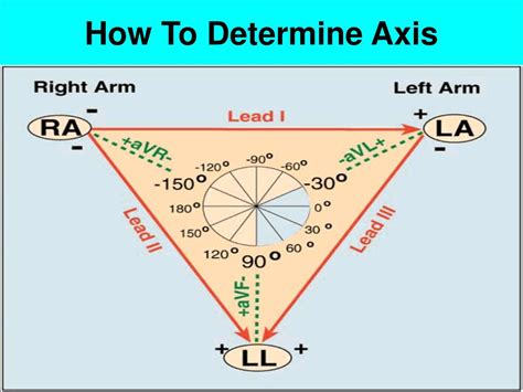 PPT ECG Lecture Part 1 ECG Interpretation Selim Krim MD Assistant Professor PowerPoint