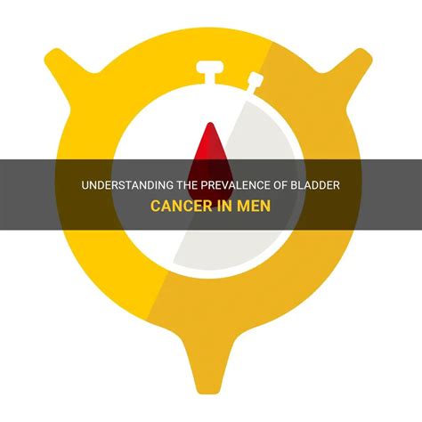 Understanding The Prevalence Of Bladder Cancer In Men Medshun