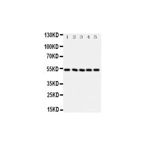 Smad6 Antibody Novatein Biosciences