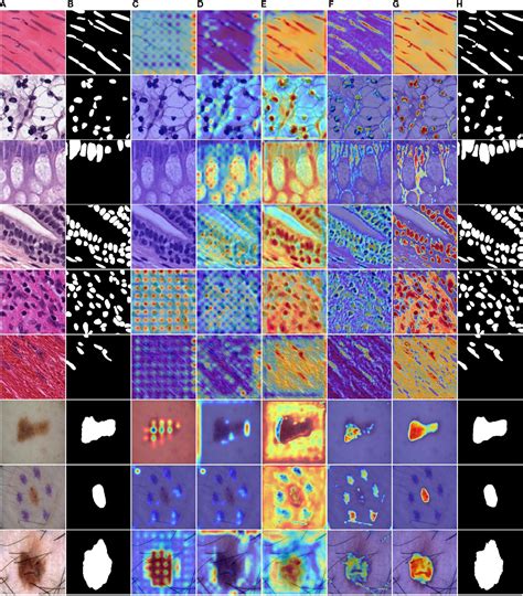 Frontiers Lightweight Semantic Segmentation Network For Tumor Cell