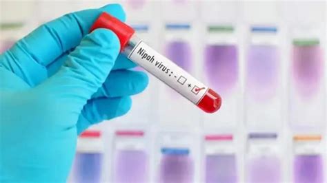 Nipah Virus In Kerala 32 Year Old Man Found Positive For Nipah Virus Nipah Virus In Kerala 32 Year Old Man Found Positive For Nipah Virus