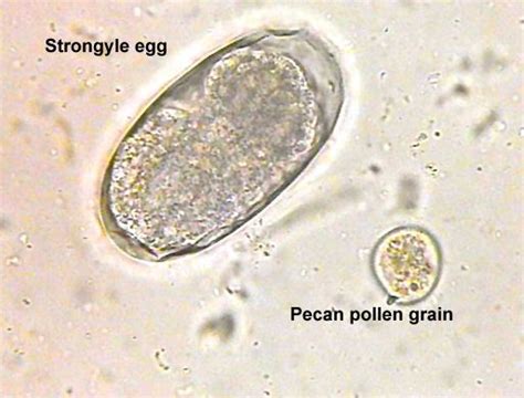 Pecan Pollen With Strongile Eggs Pollen Laboratory Science Microbiology