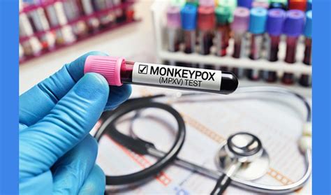 Oms Declara Fin De La Emergencia Sanitaria Internacional Por Mpox