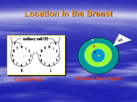 Breast Imaging Clock Face At Carrie Hernandez Blog