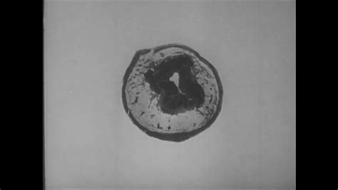 1930s Drawing Of Human Appendix Cross Section Of Appendix With