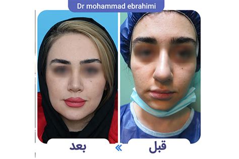 دکتر محمد ابراهیمی فوق تخصص جراحی پلاستیک و زیبایی