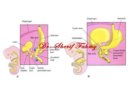 Development Of Duodenum Special Embryology Pps