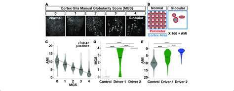 Automated Morphology Index Ami Significantly Correlates With Manual