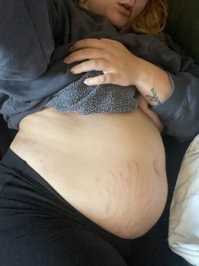 New Stretch Marks Every Day I Swear Tumbex
