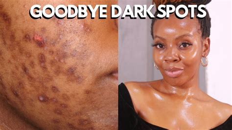 Ascorbic Acid Vitamin C Ascorbic Acid 8alpha Arbutin 2 Truth About