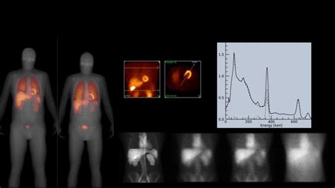 Simind Monte Carlo Program Medical Radiation Physics Simind Monte Carlo Program Medical Radiation Physics
