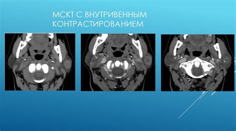 Лучевая диагностика заболеваний слюнных желез Online Presentation