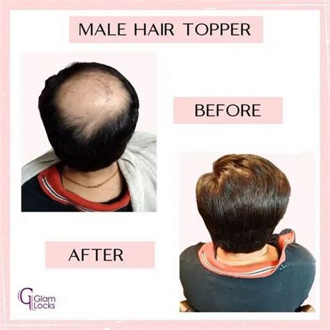 Glam Locks Natural Monofilament Regular Mens Hair Patch For Personal