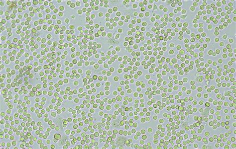 In Vitro Derived Mast Cells Genoskin Eu Shop