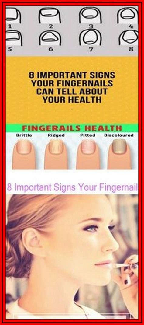 8 Important Signs Your Fingernails Can Tell About Your Health Nail
