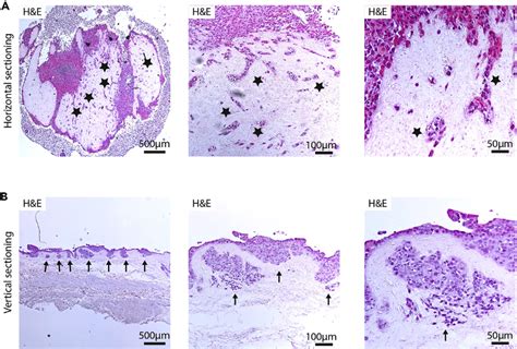 Examples Of Successful Engraftment And Sectioning Orientation A