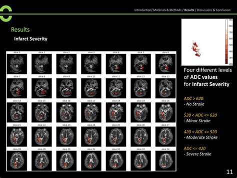Deep Learning Based Fully Automated Detection And Quantification Of